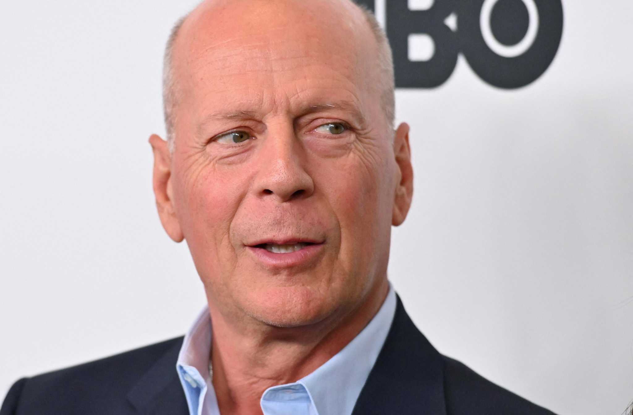 Bruce Willis Has Frontotemporal Dementia What Is FTD 