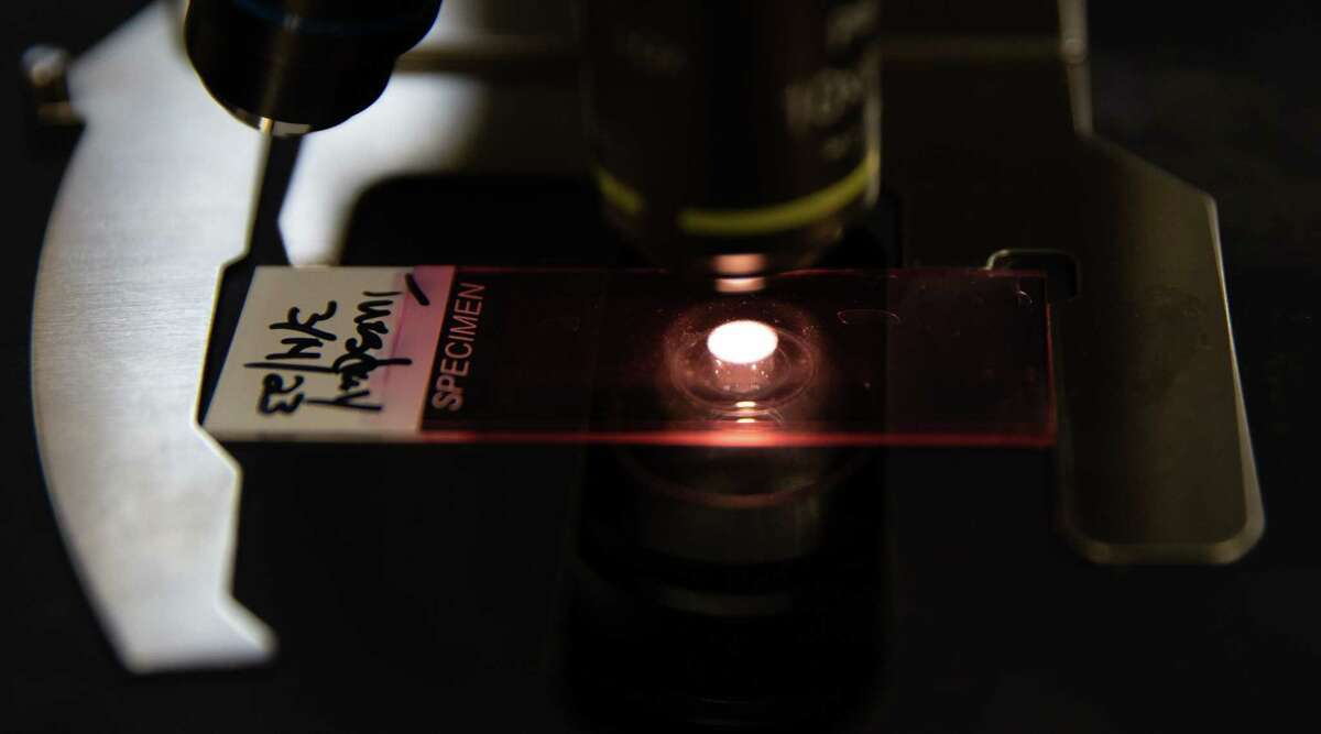 See how Houston counts pollen and mold spores for allergy season