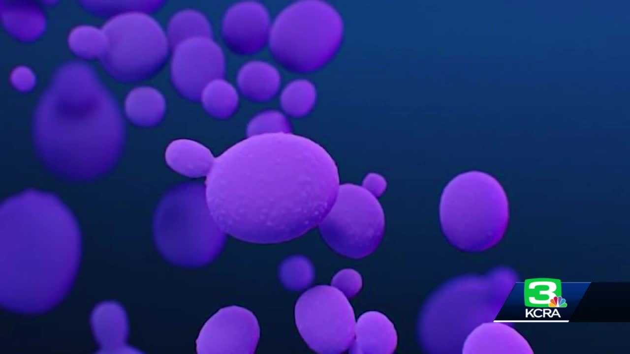 C. auris fungus can be stubborn and potentially deadly at long-term ...