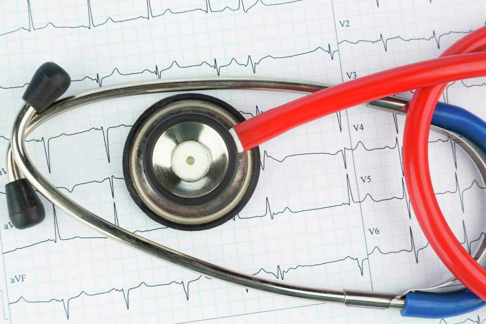 Heart attacks are killing more young people. It’s not just COVID