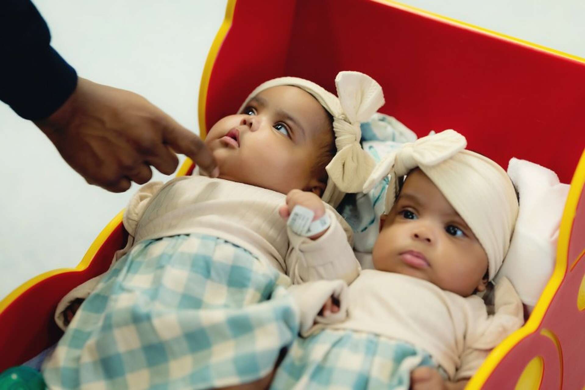 Texas conjoined twins separated by surgery finally go home