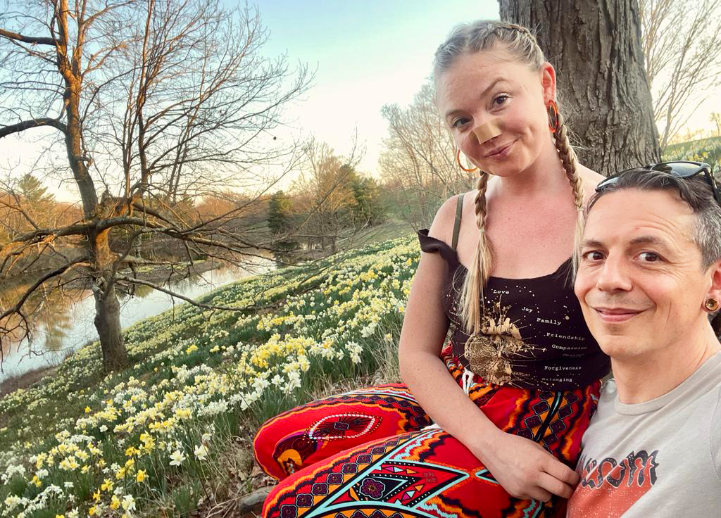 CT woman mauled by pet dog consulting top surgeons to reconstruct nose