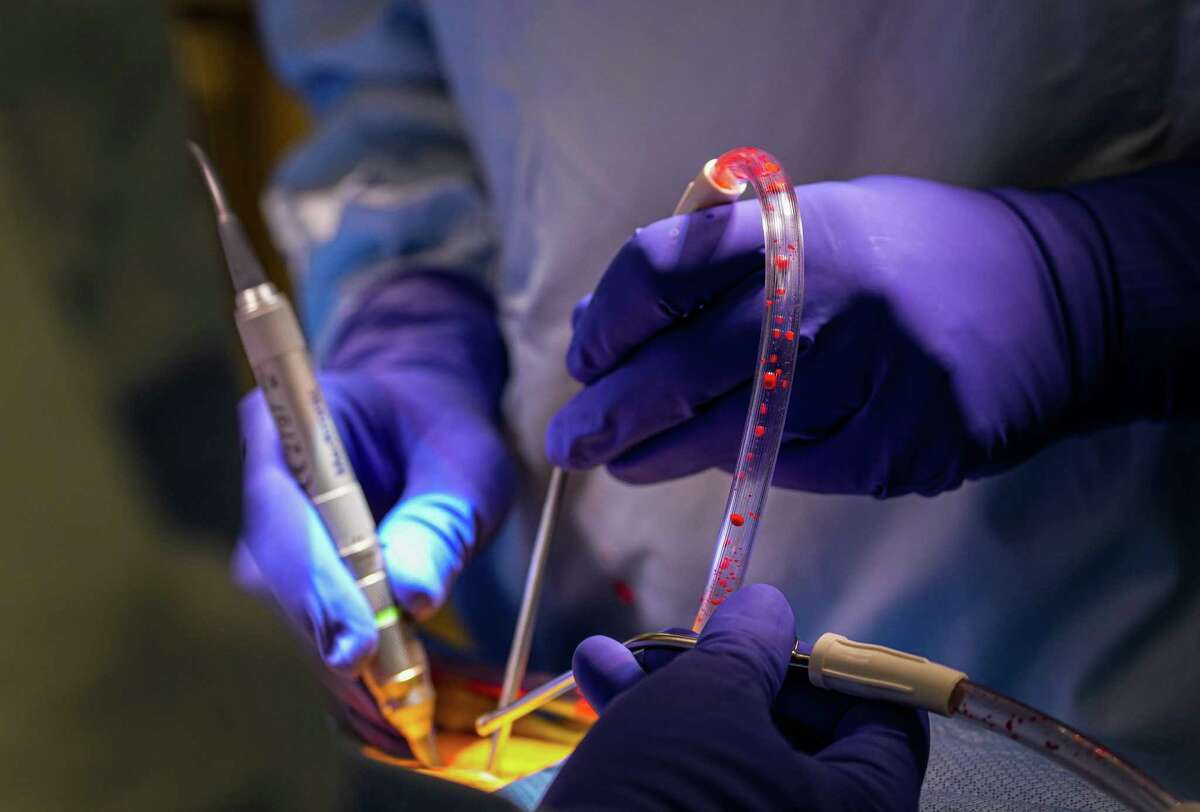 Texas twins with cerebral palsy receive innovative surgery in Houston