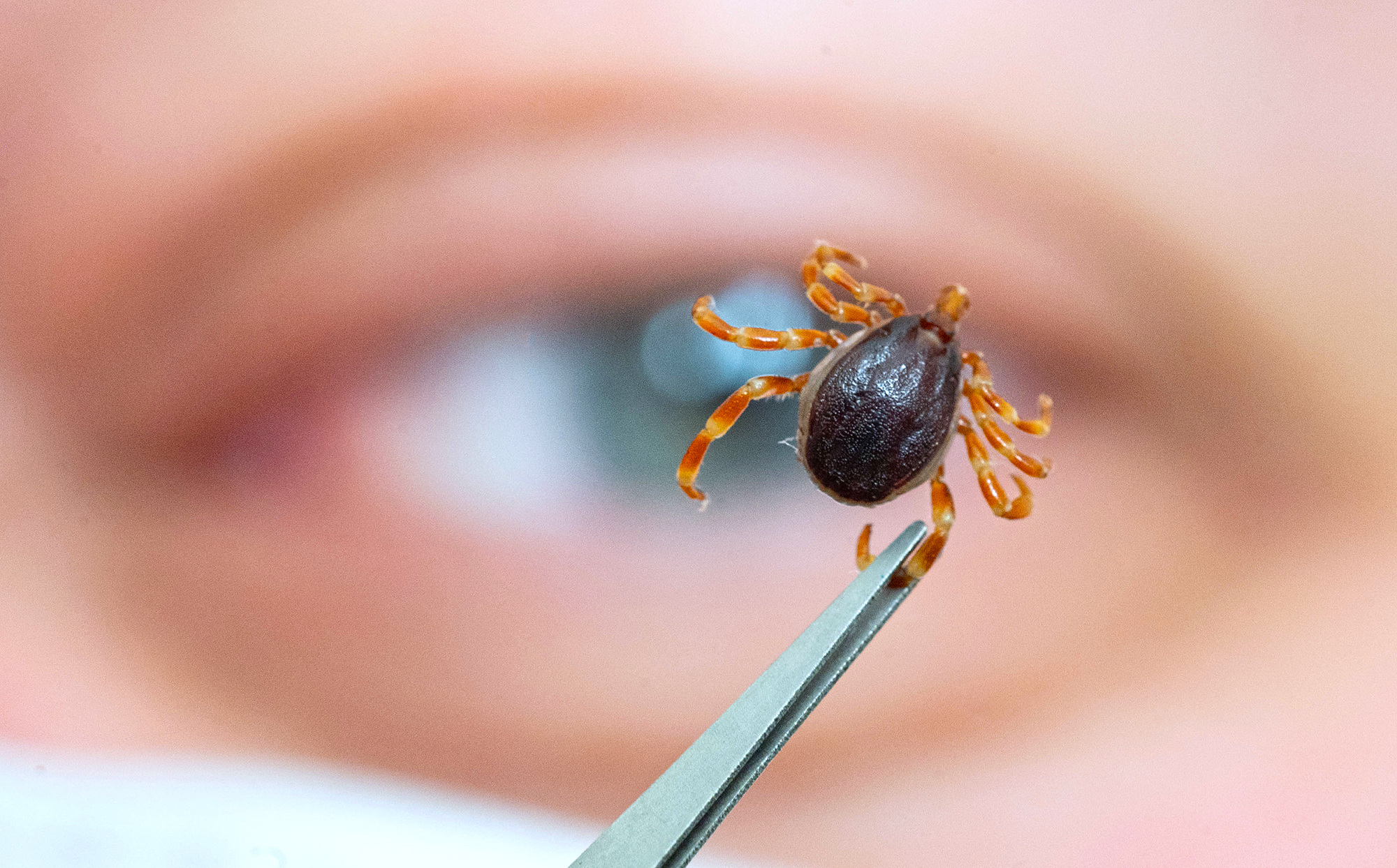 How to stay safe against ticks during this year's season