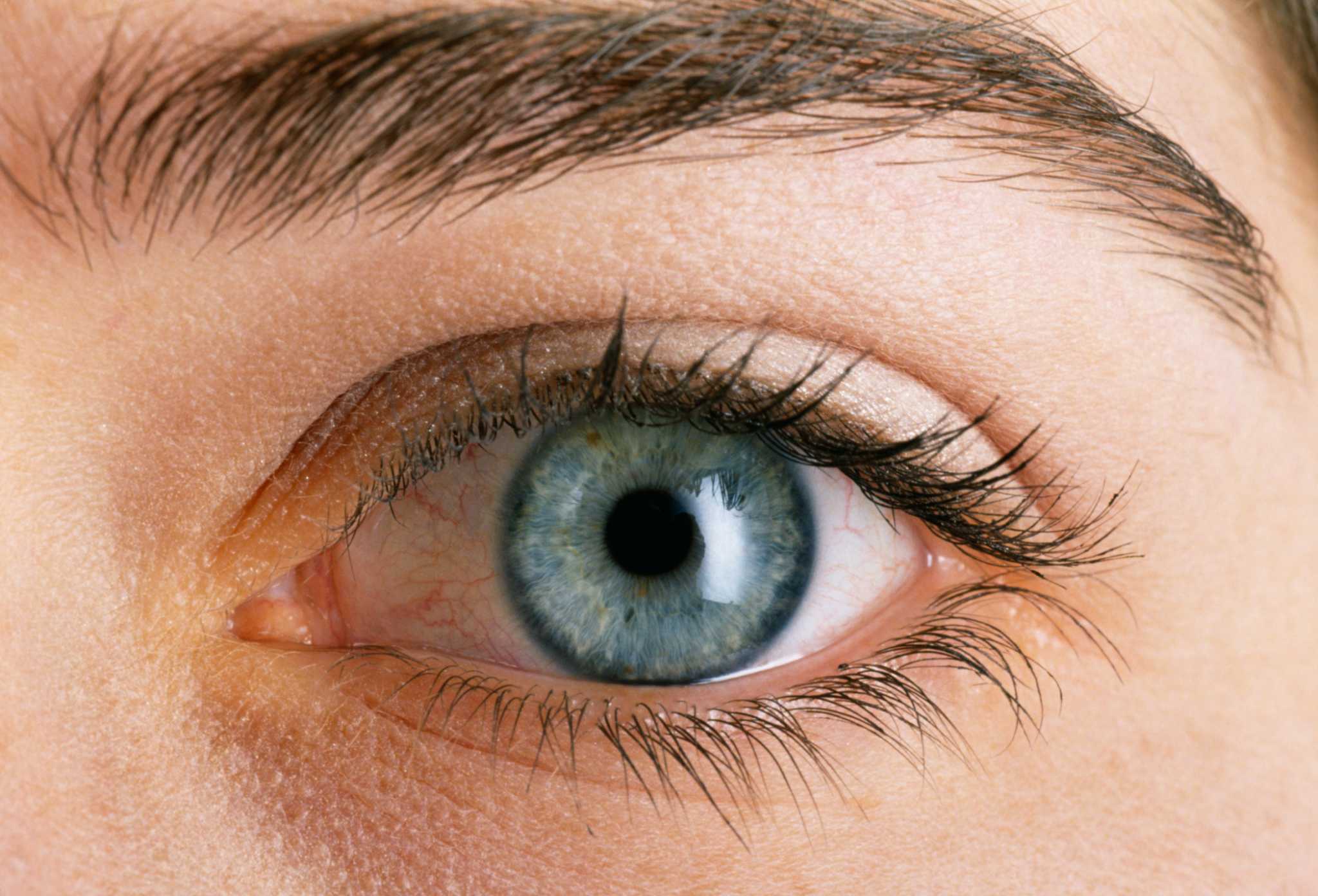 Does Zinc Help Prevent Eye Styes?