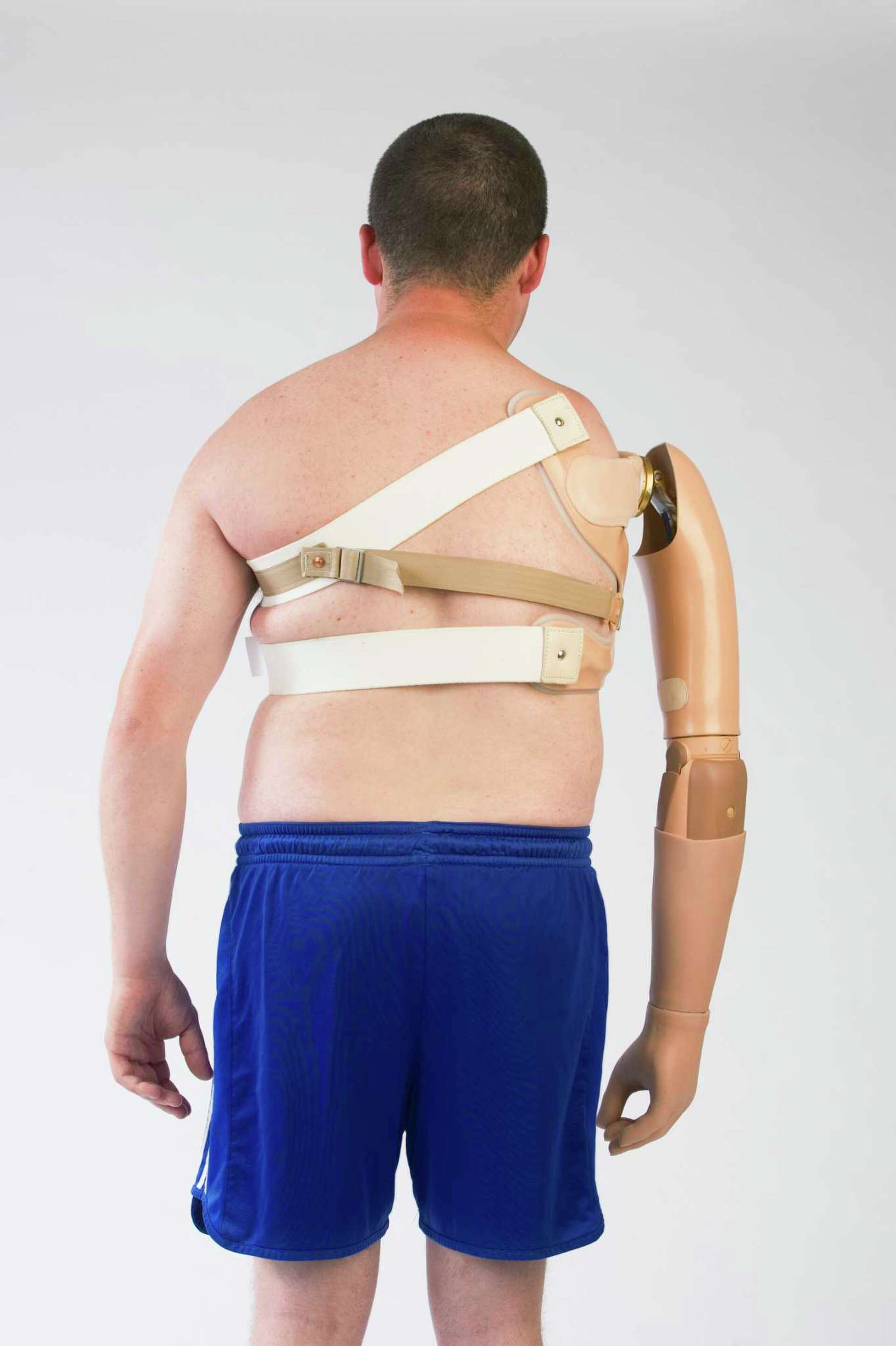 How Do Electronic Prosthetics Work?