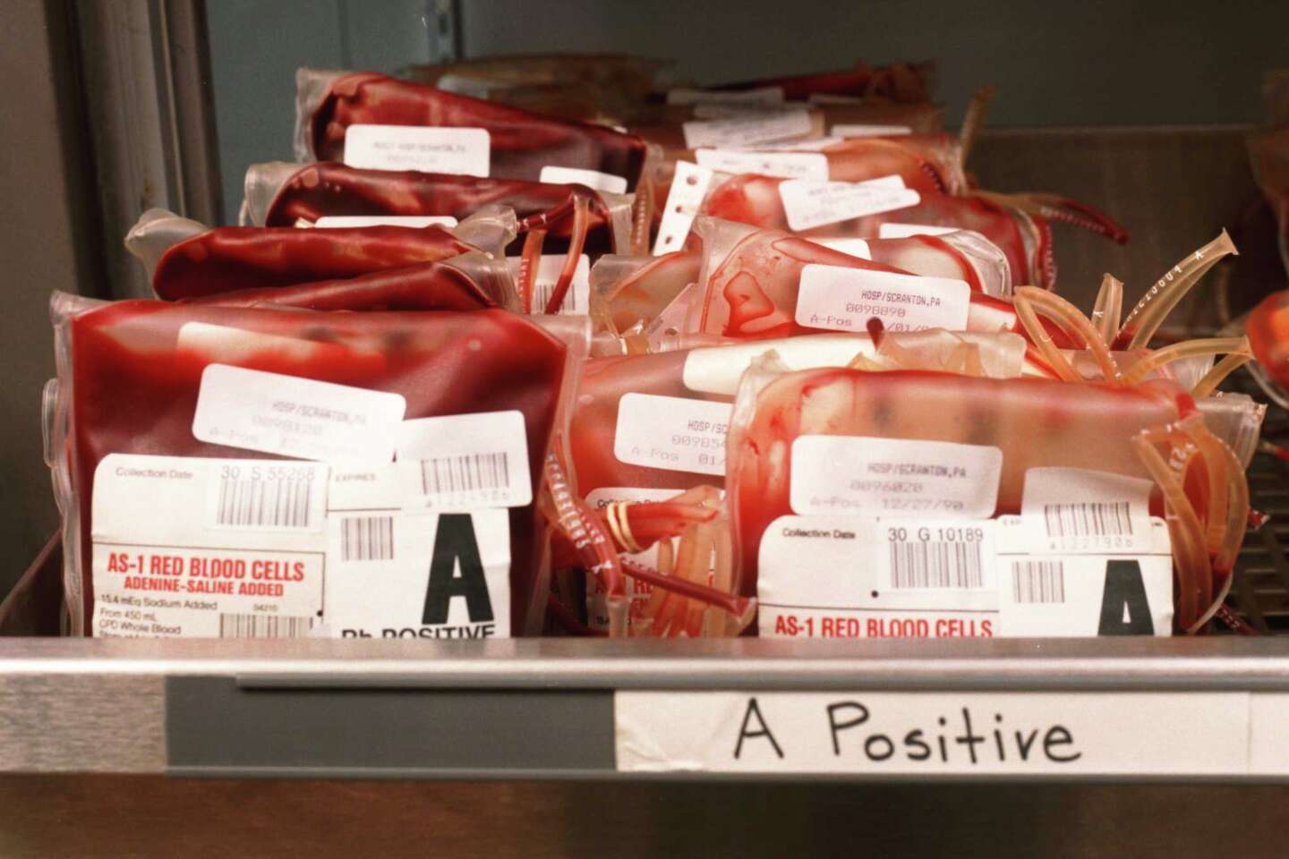 What Happens When You Give Someone the Wrong Blood Type?