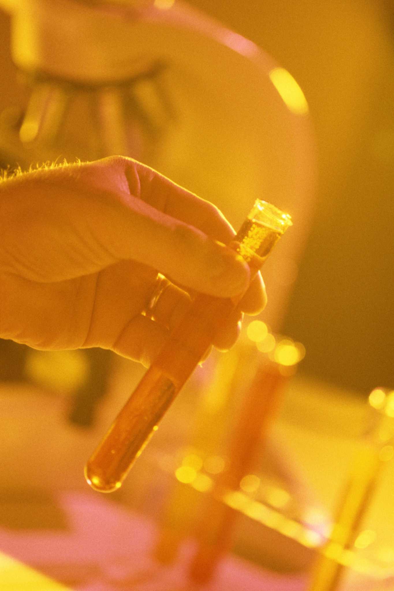What Kinds Of Tests Do Doctors Do To Check Why You Have High Blood