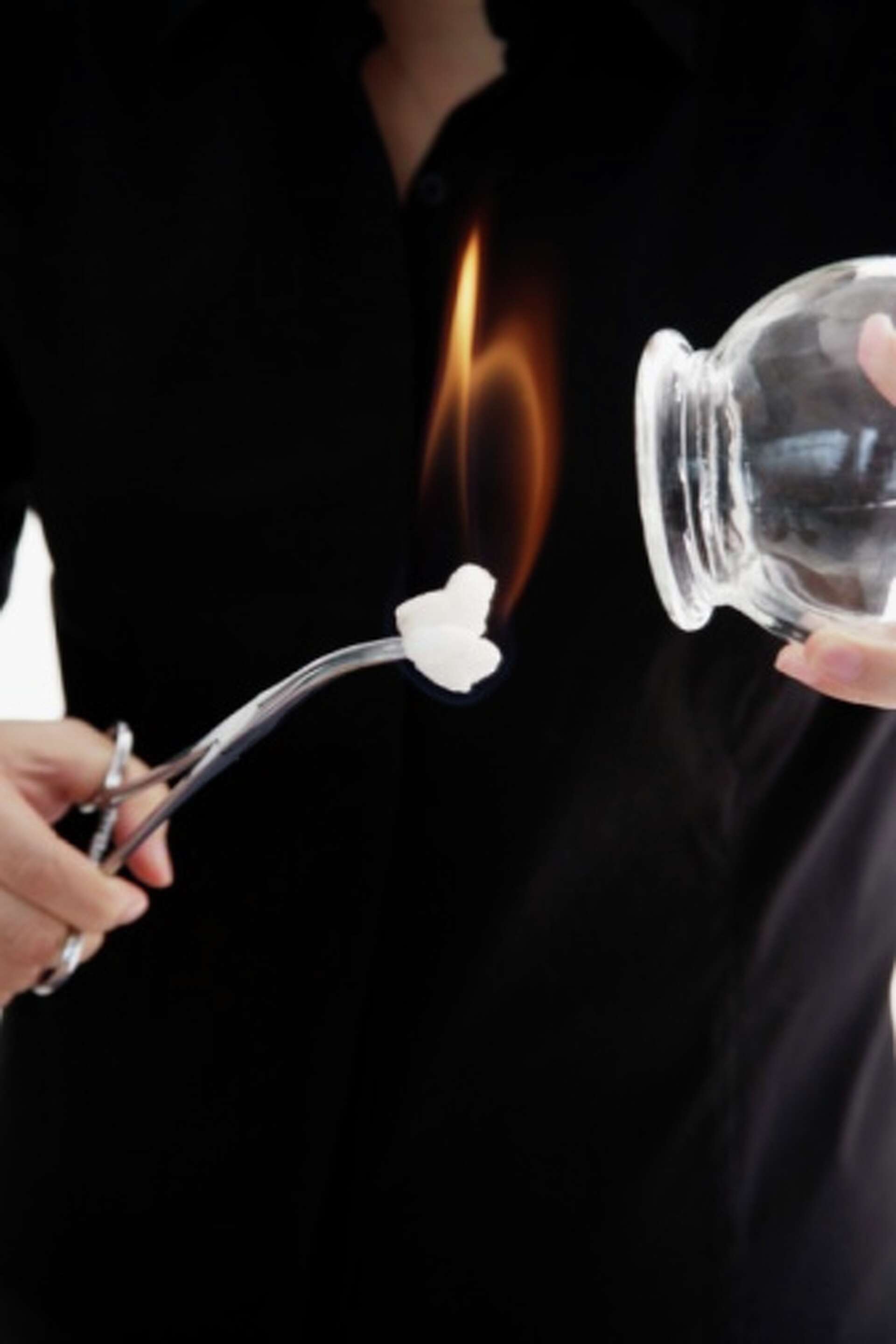 How to Perform Fire Cupping
