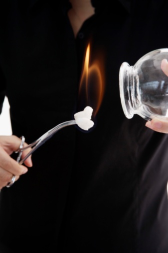 How to Perform Fire Cupping