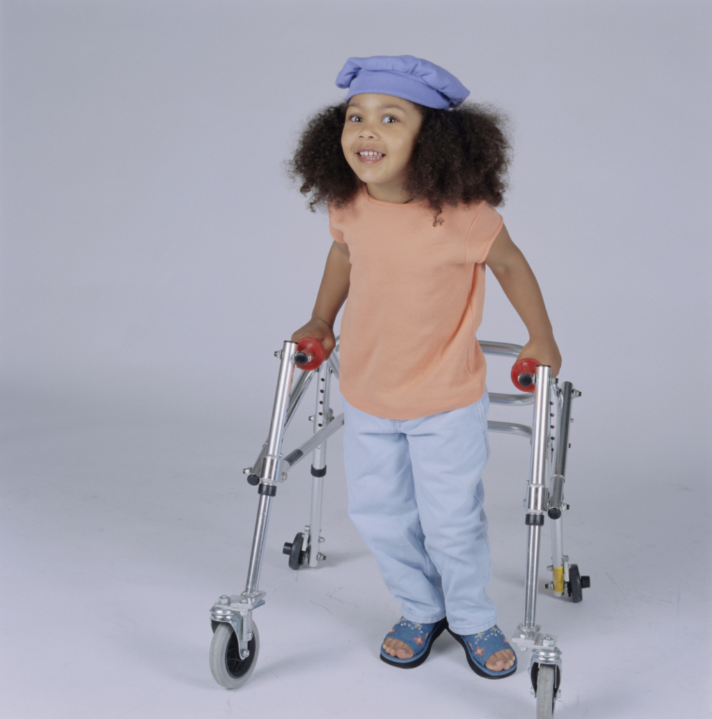 Monoplegic Cerebral Palsy