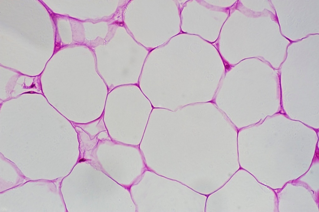 More THC, less body fat – new study tells us why