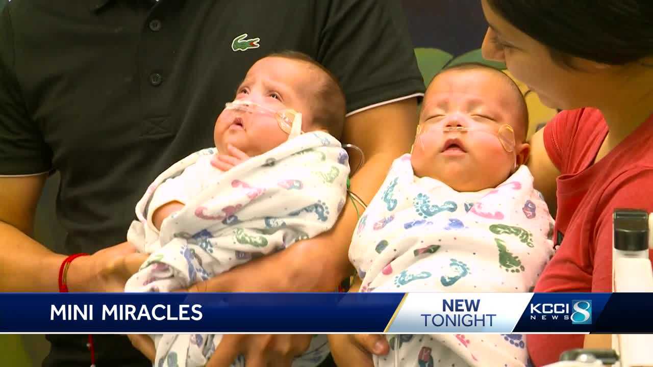 Mini miracles: Iowa babies born at 22 weeks are heading home