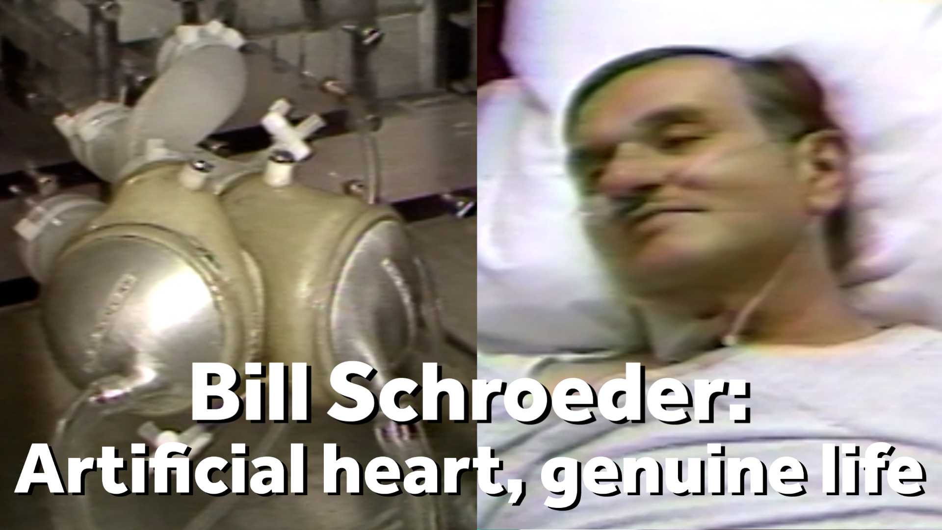 Man lived 620 days after given mechanical heart in ‘80s