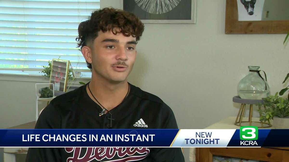 Fireworks accident costs young baseball player his hand