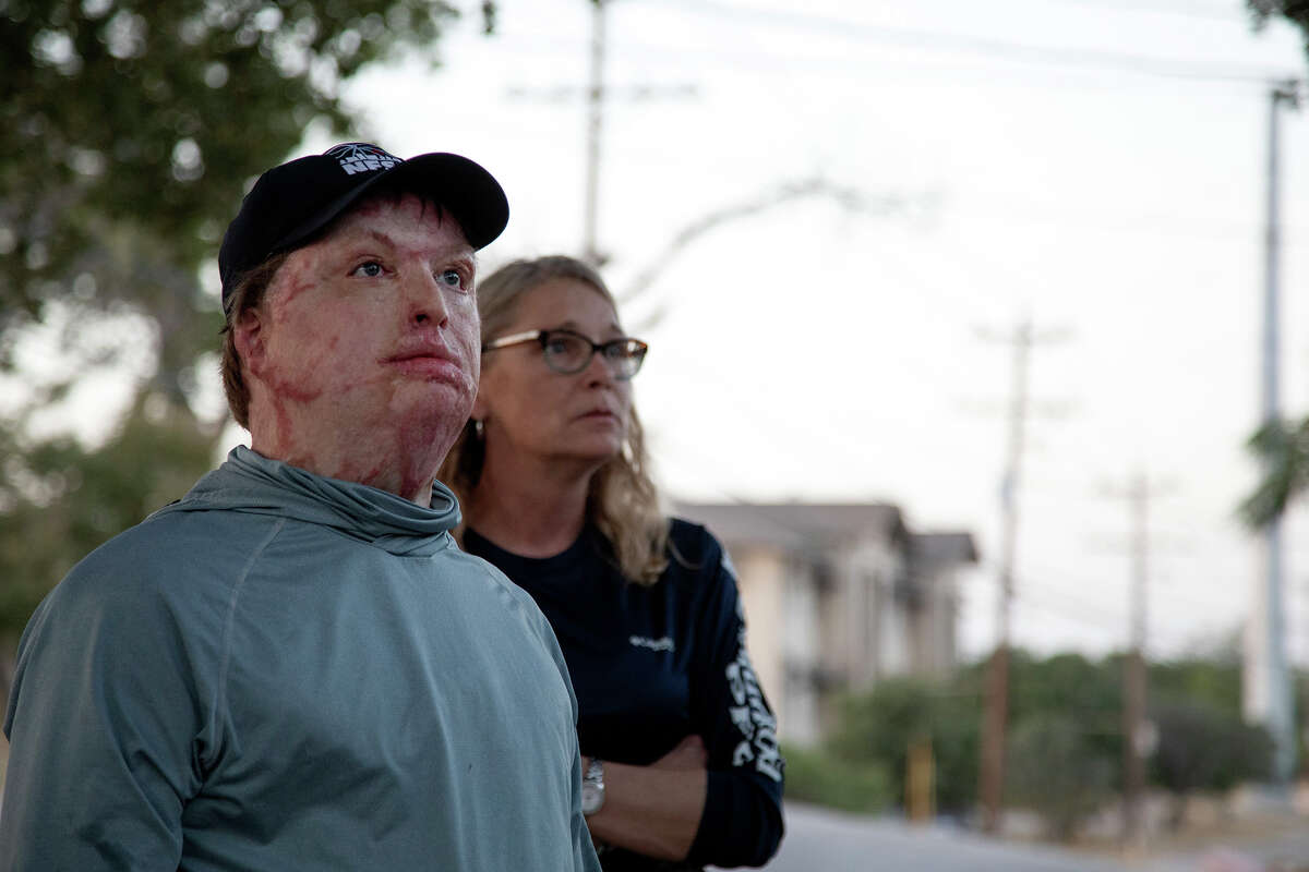 Burn survivor returns to site of deadly San Marcos apartment fire