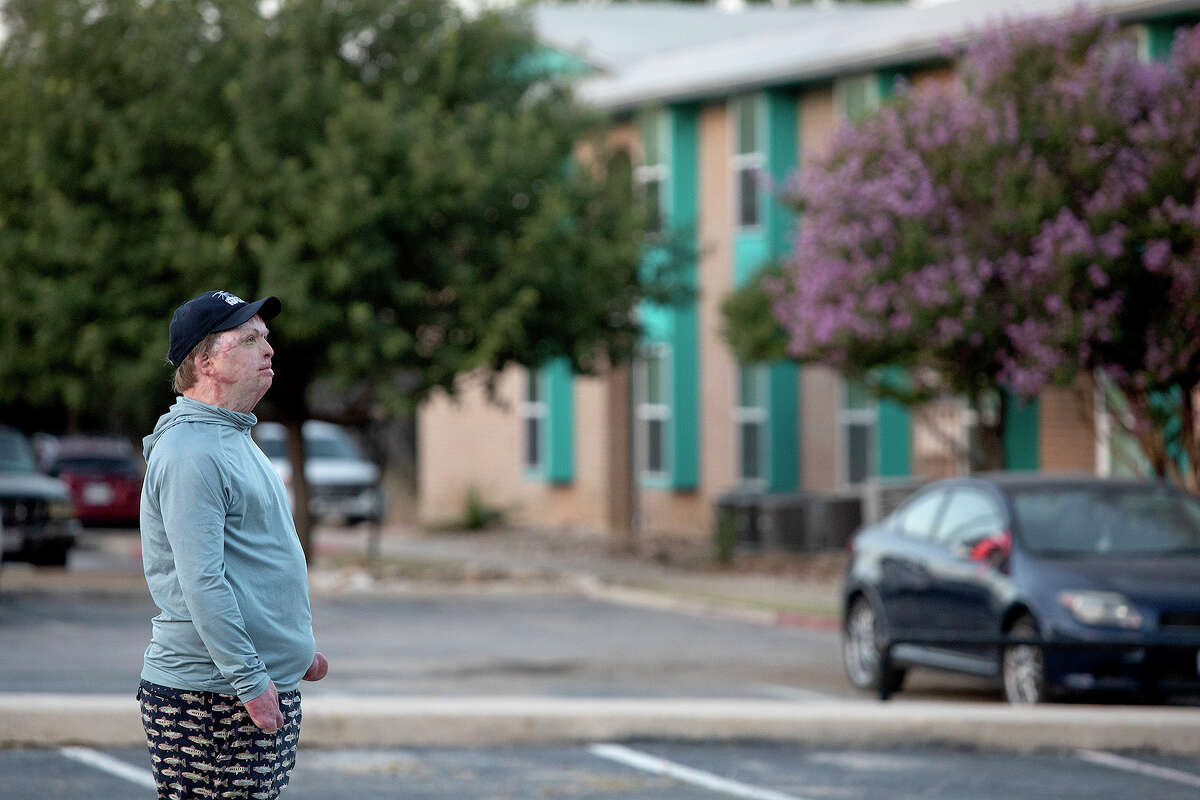 Burn survivor returns to site of deadly San Marcos apartment fire