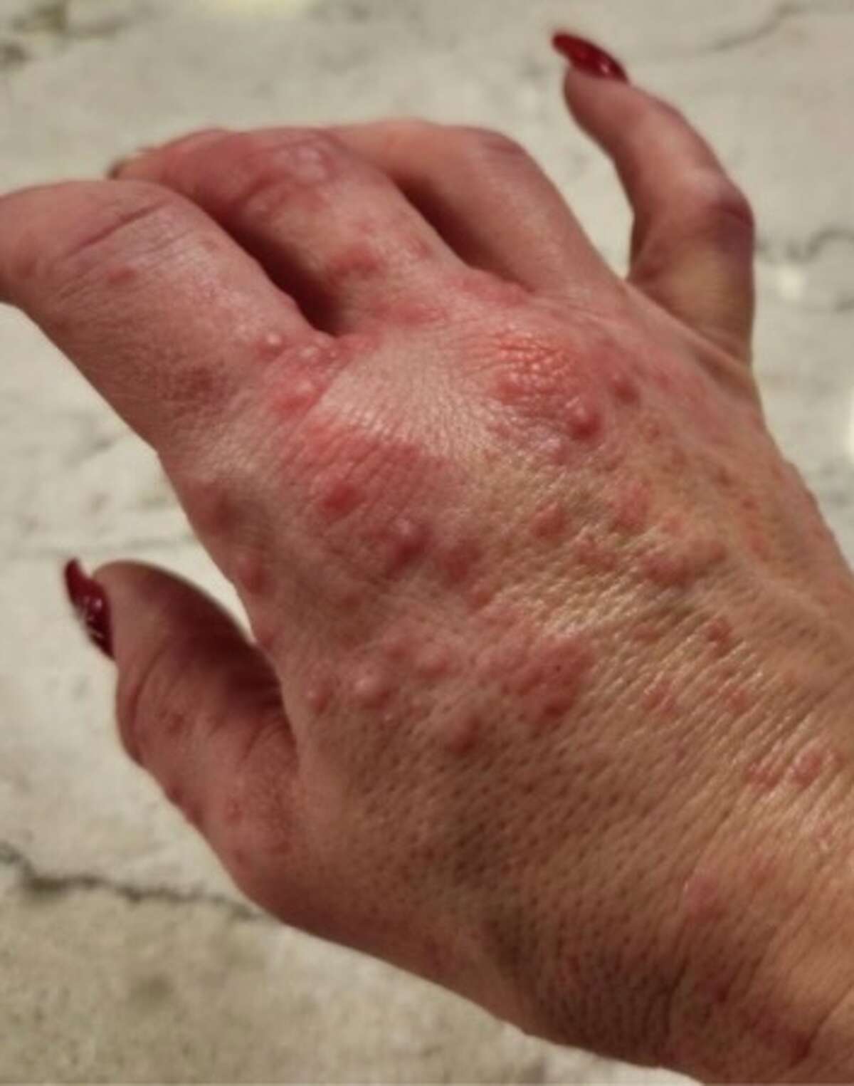 Houston woman says Aroma360 scented candle 'exploded,' injuring her