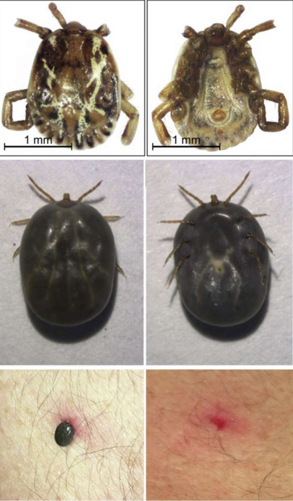 CT scientists warn of new invasive tick species coming from overseas