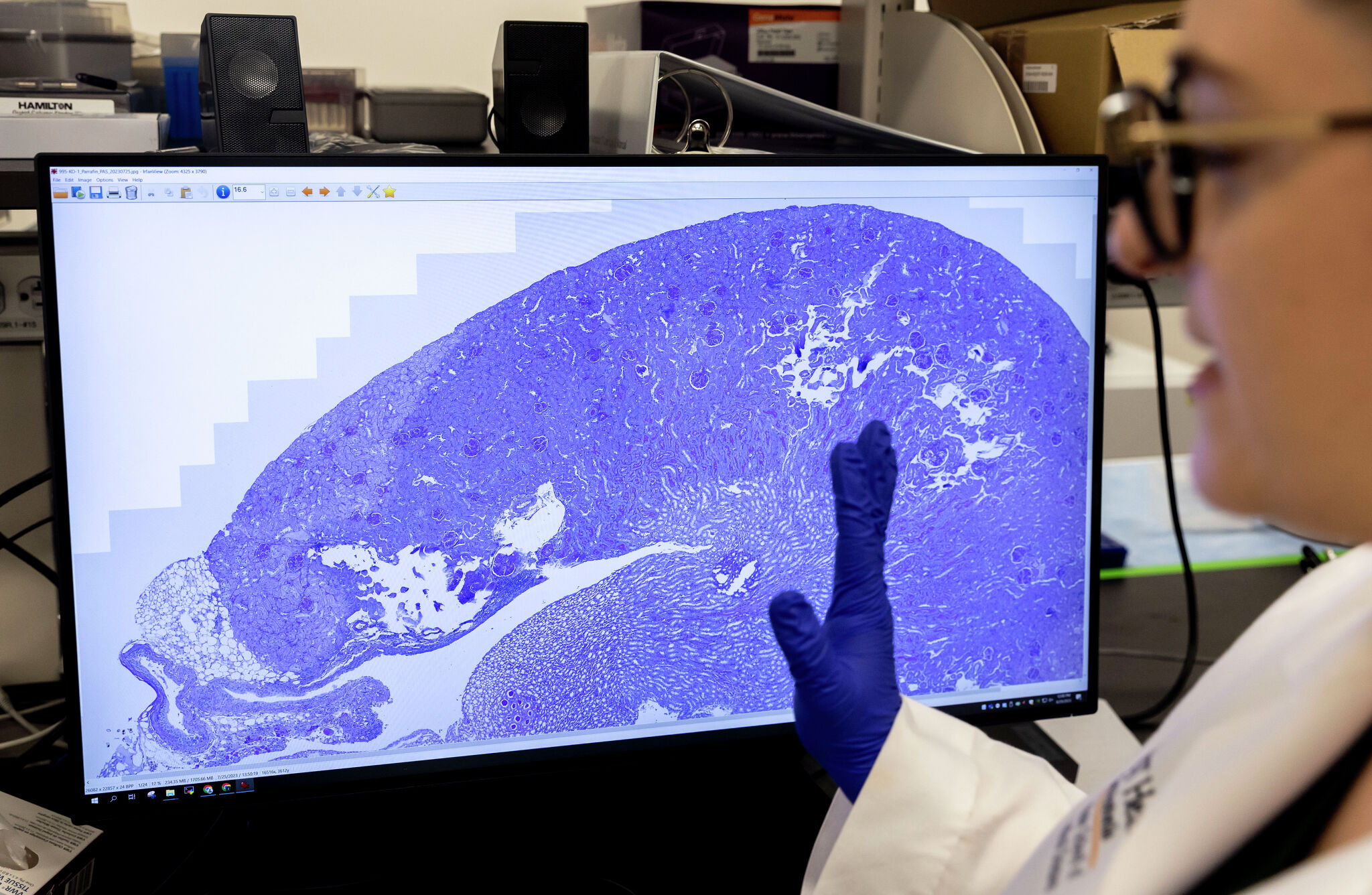UT Health scientists create first mice with human immune systems