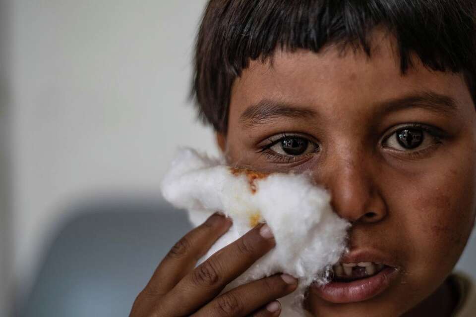 A flesh-eating parasite may now be 'endemic' in Texas, the CDC says