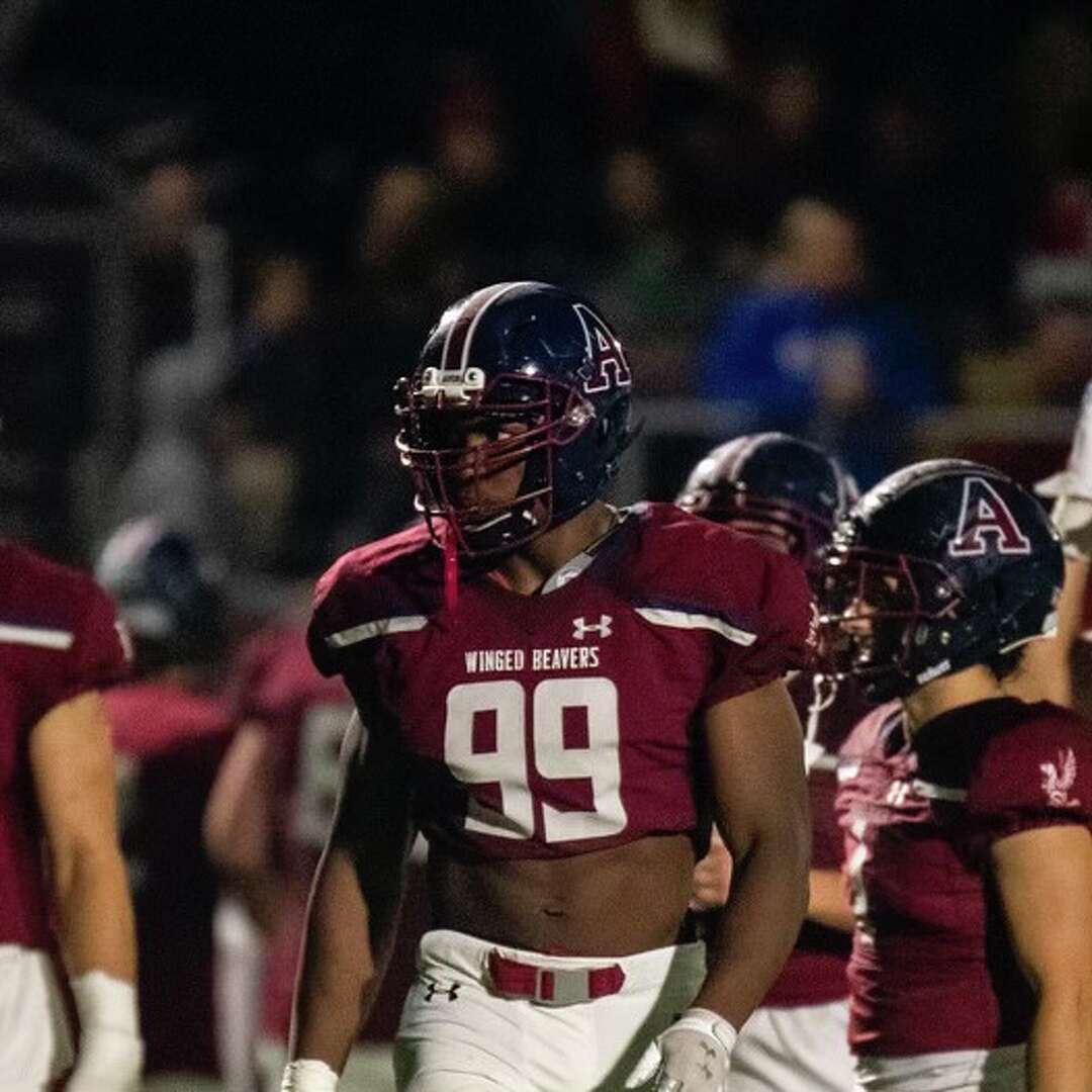 Top recruit Benedict Umeh gets Stanford’s support in cancer fight