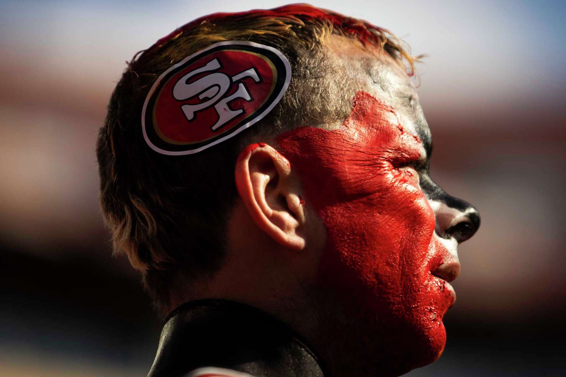 There are no excuses if 49ers lose to Lions, so cancel the whine party