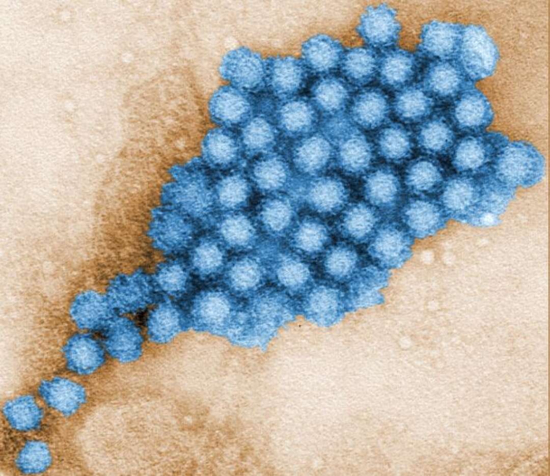 Norovirus cases surge in CT as highly contagious variant spreads