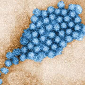 Norovirus in CT: Symptoms, spread and how to prevent infection