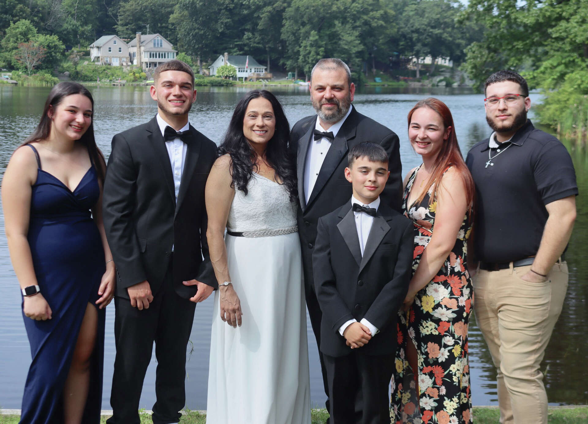 CT woman diagnosed with chronic liver disease hopeful for live donor