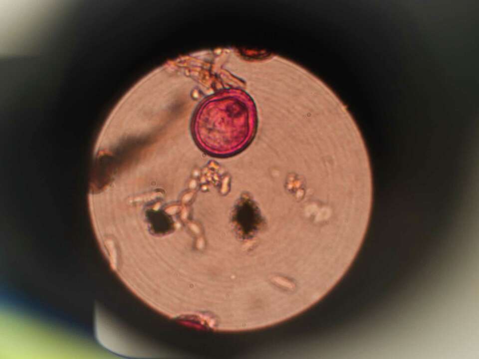 Houston pollen count: How it's measured, what it means