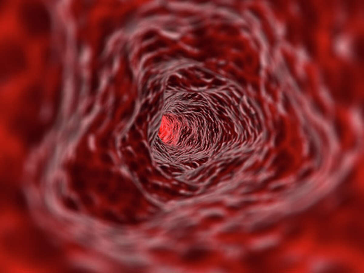 You name it, there's a phobia for it