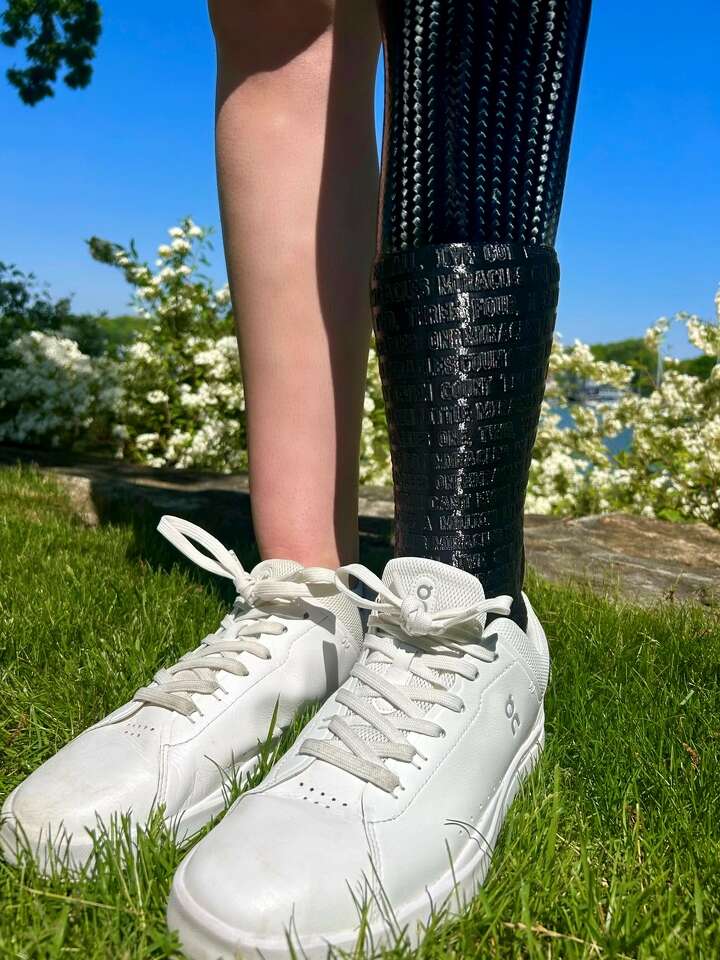 Yale swimmer eyes Paralympics after losing leg in shark attack