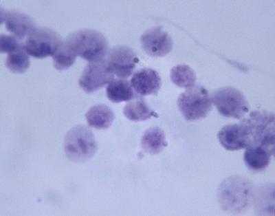 diffusion examples in the body