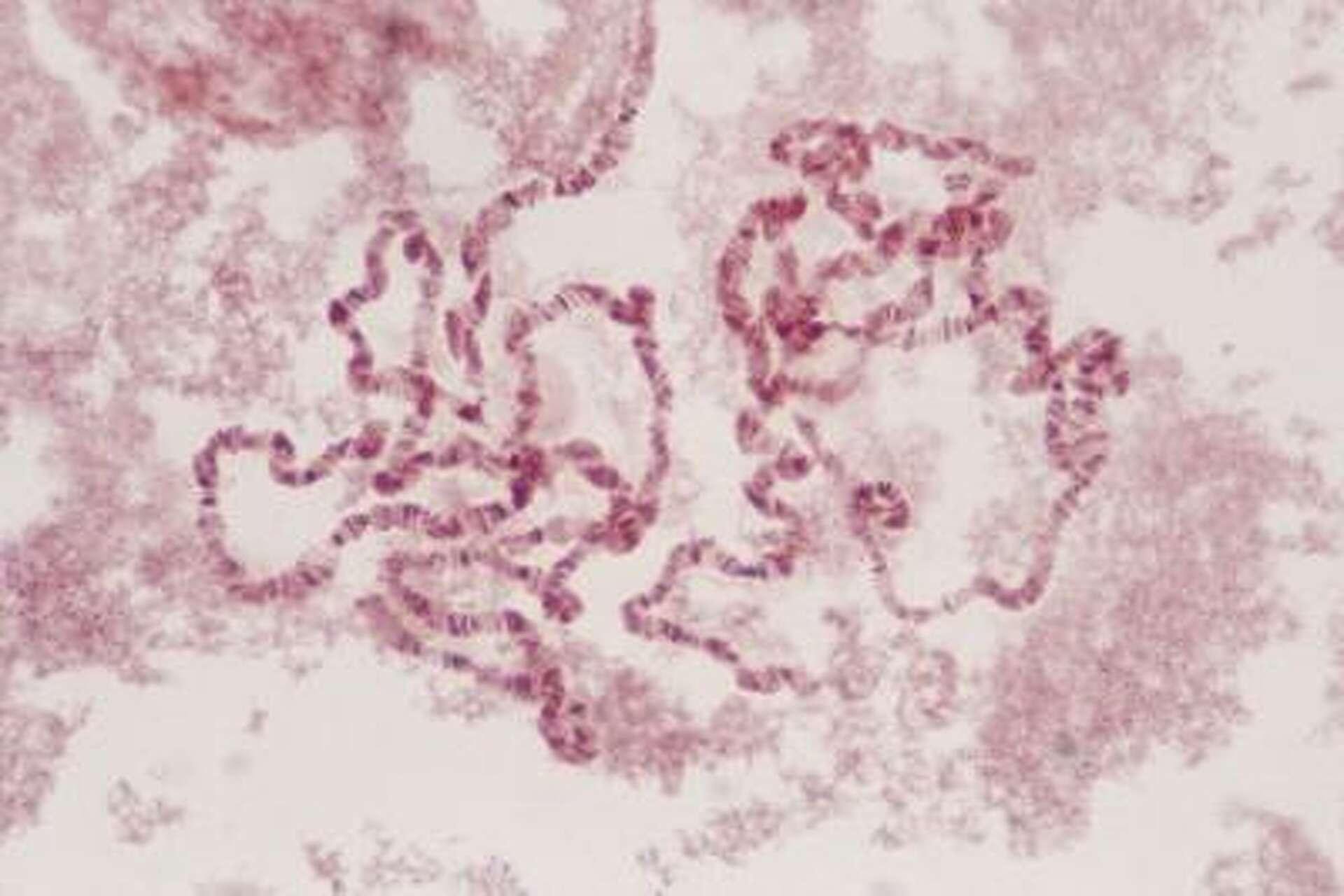 human epithelial cells microscope