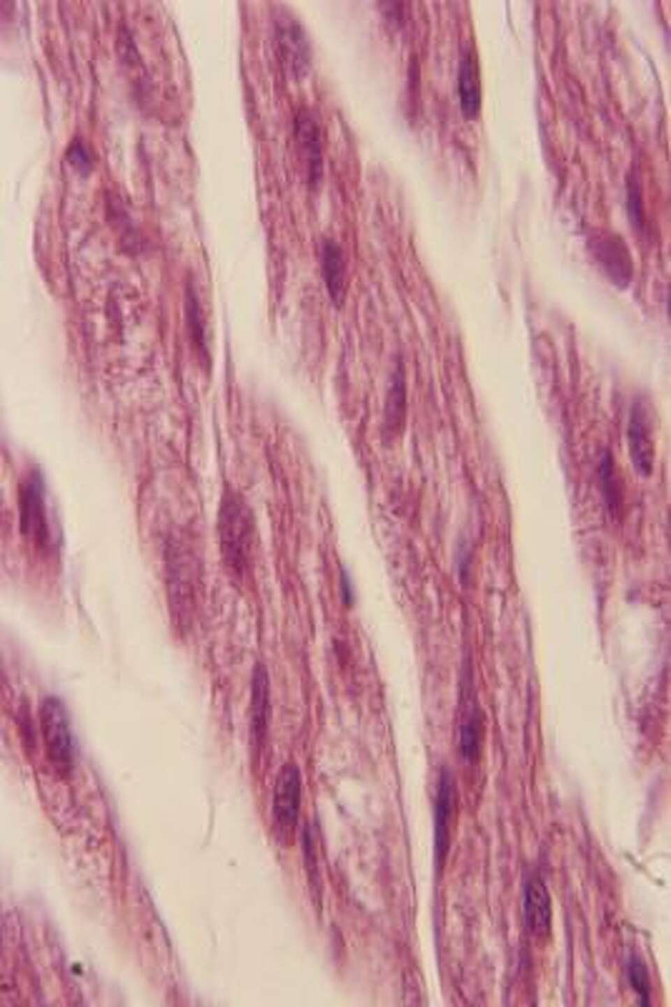 What Organelle Must Be Present in Large Numbers in Muscle Cells?