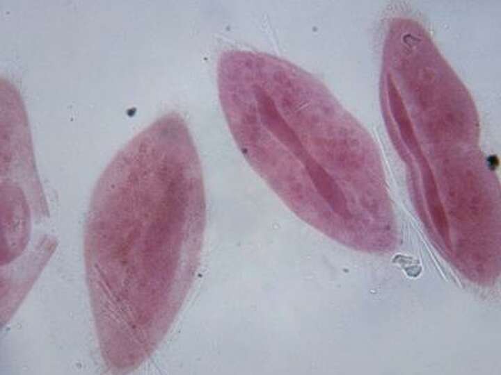List of Several Examples of Eukaryotes