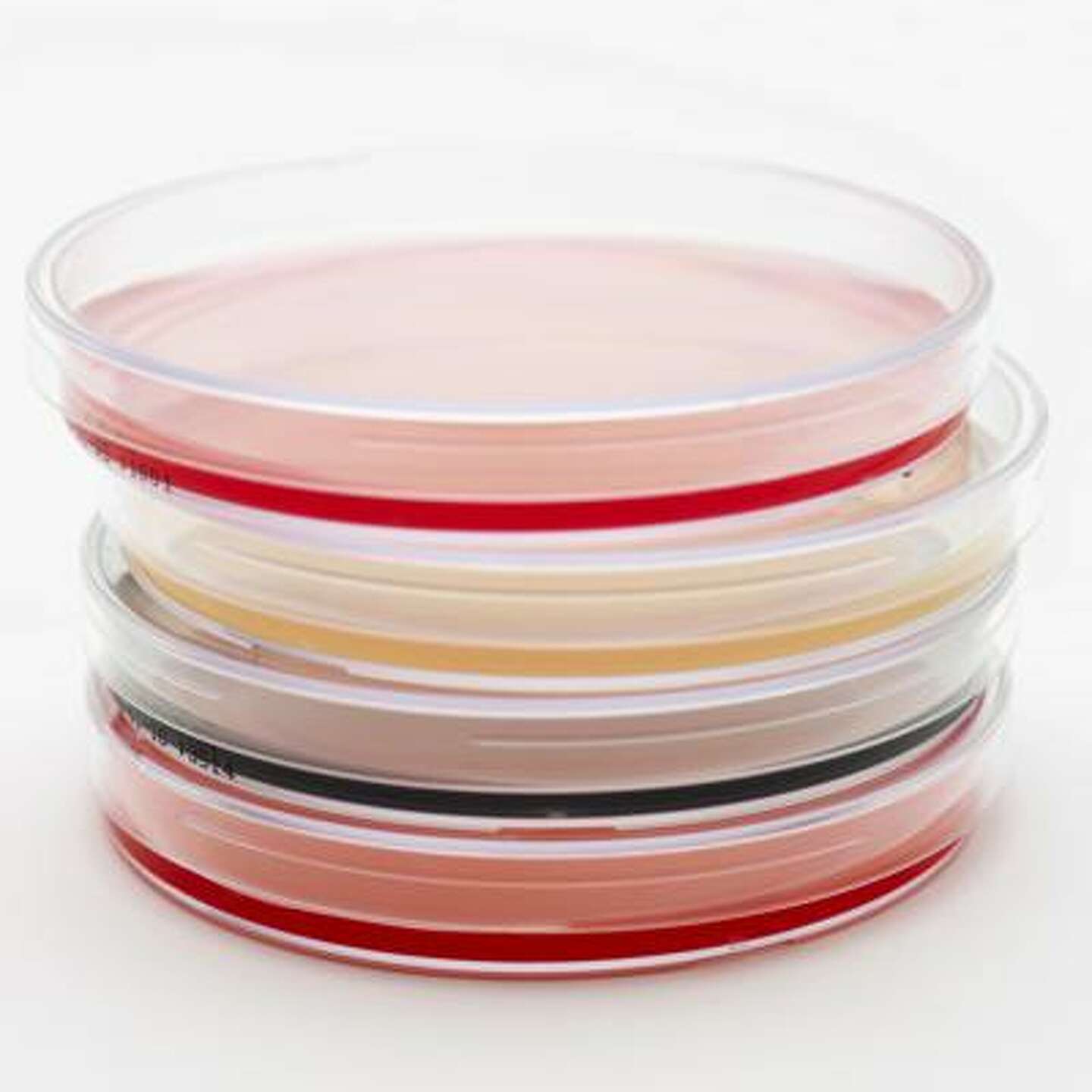 The Best Ways to Grow Bacteria on Agar