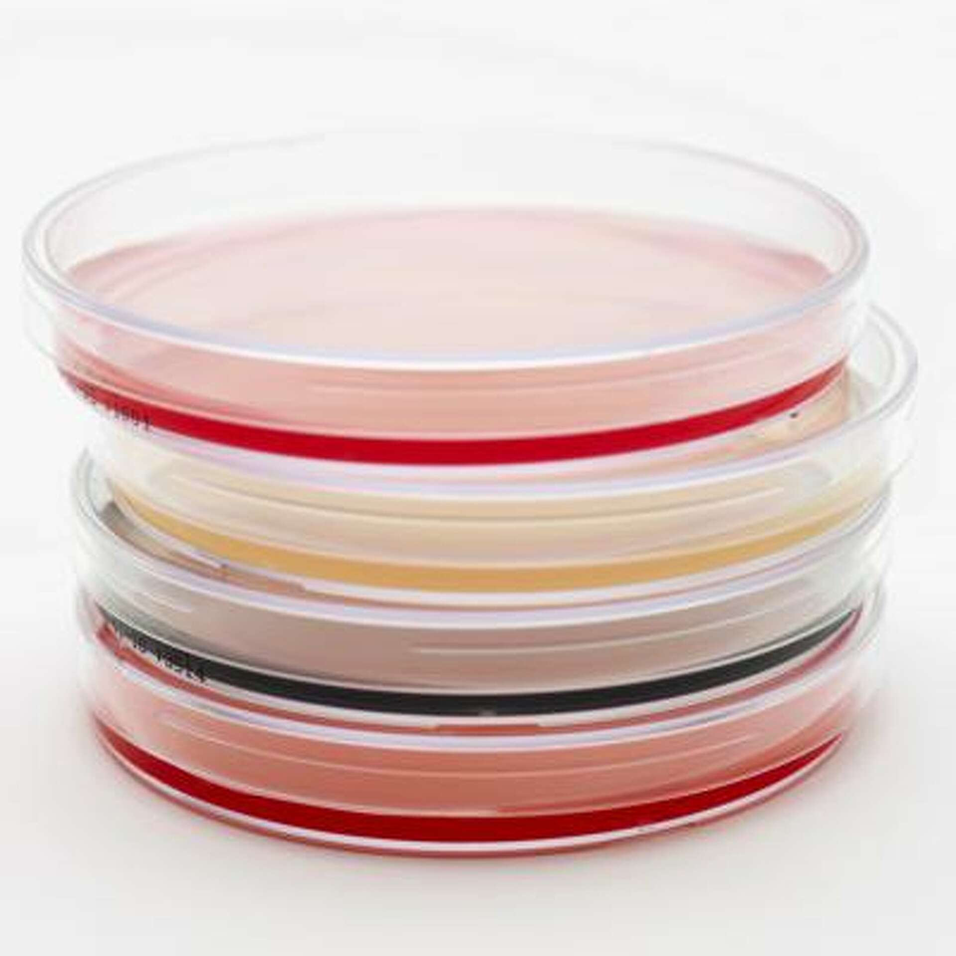 The Best Ways to Grow Bacteria on Agar
