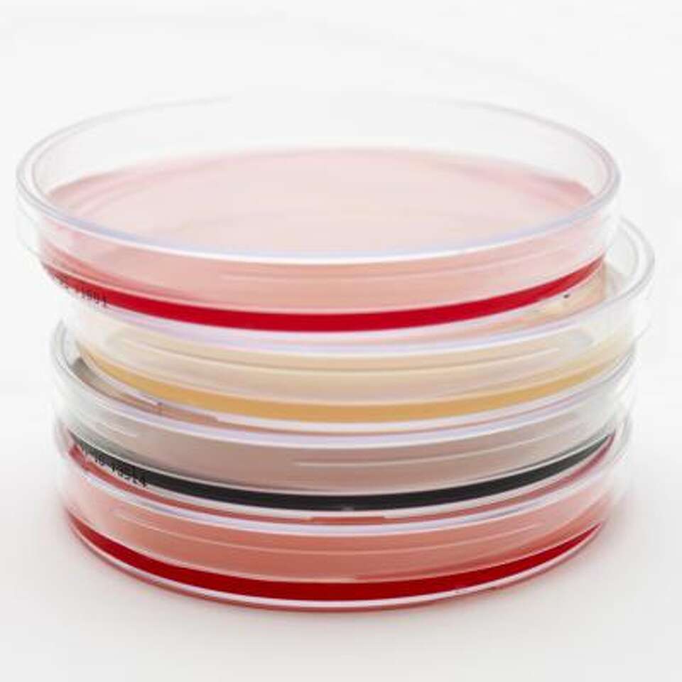 The Best Ways to Grow Bacteria on Agar