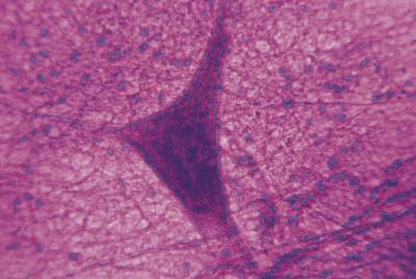 The Average Life Span of Human Nerve Cells