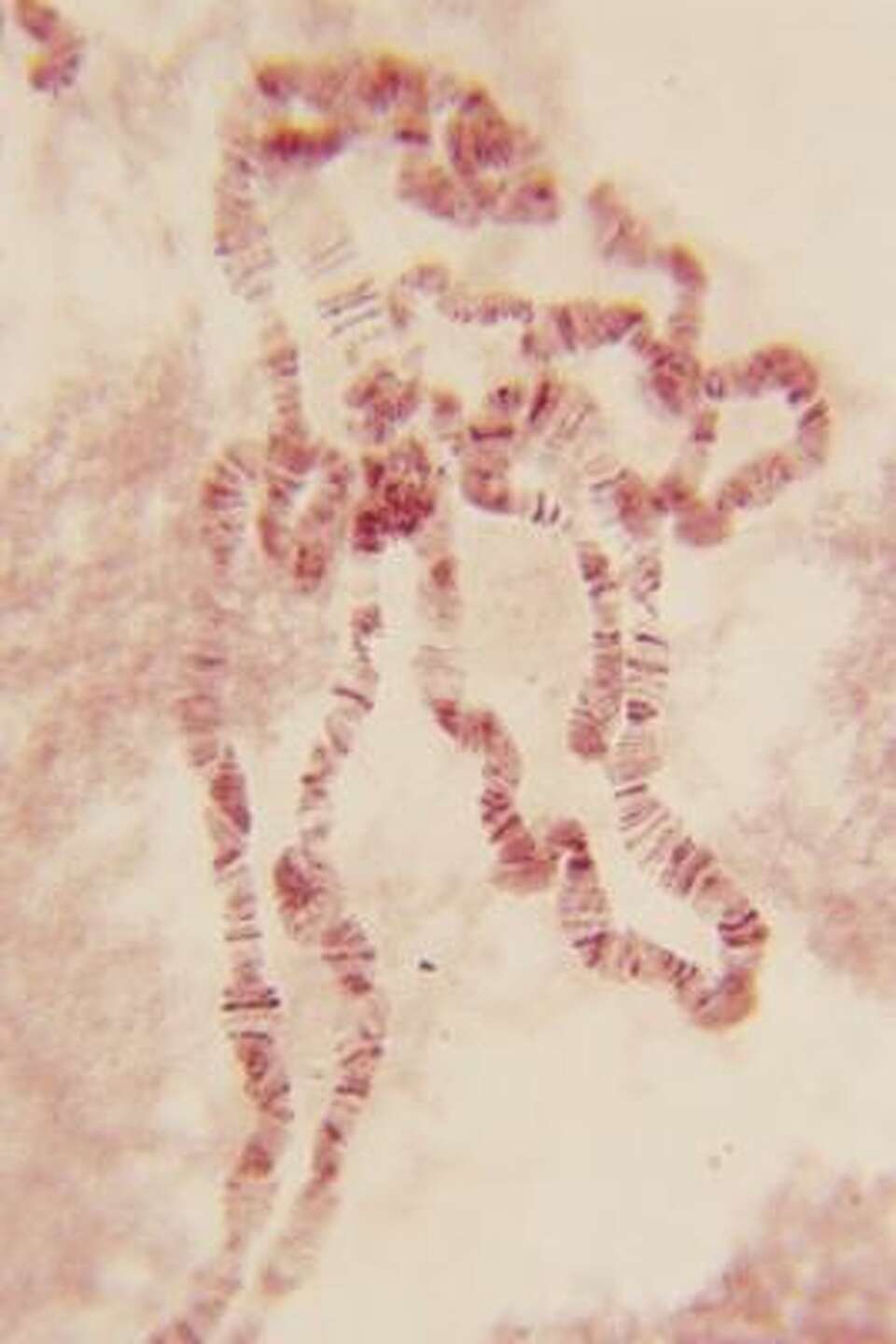What Happens When Mitosis Goes Wrong?