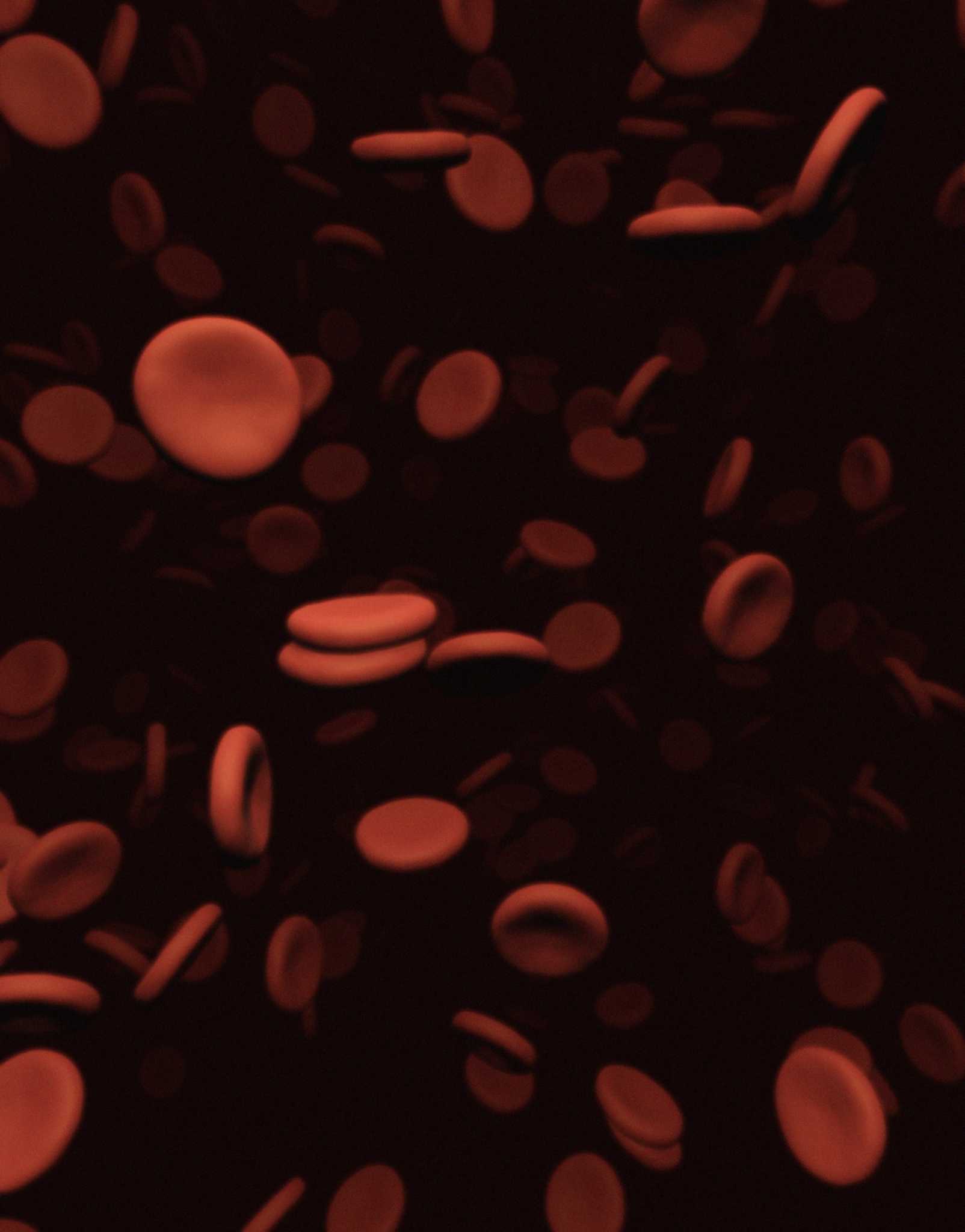 What Is High MCH in Hematology?