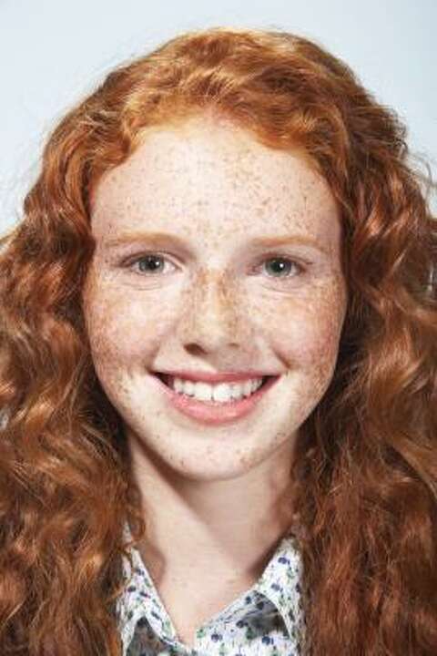 What are the Scientific Reasons for Freckles?