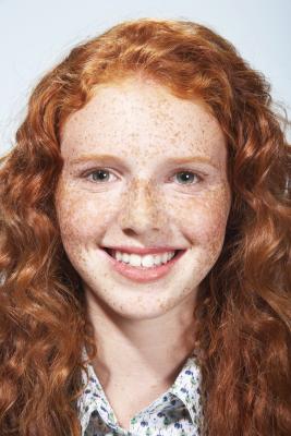 What are the Scientific Reasons for Freckles?