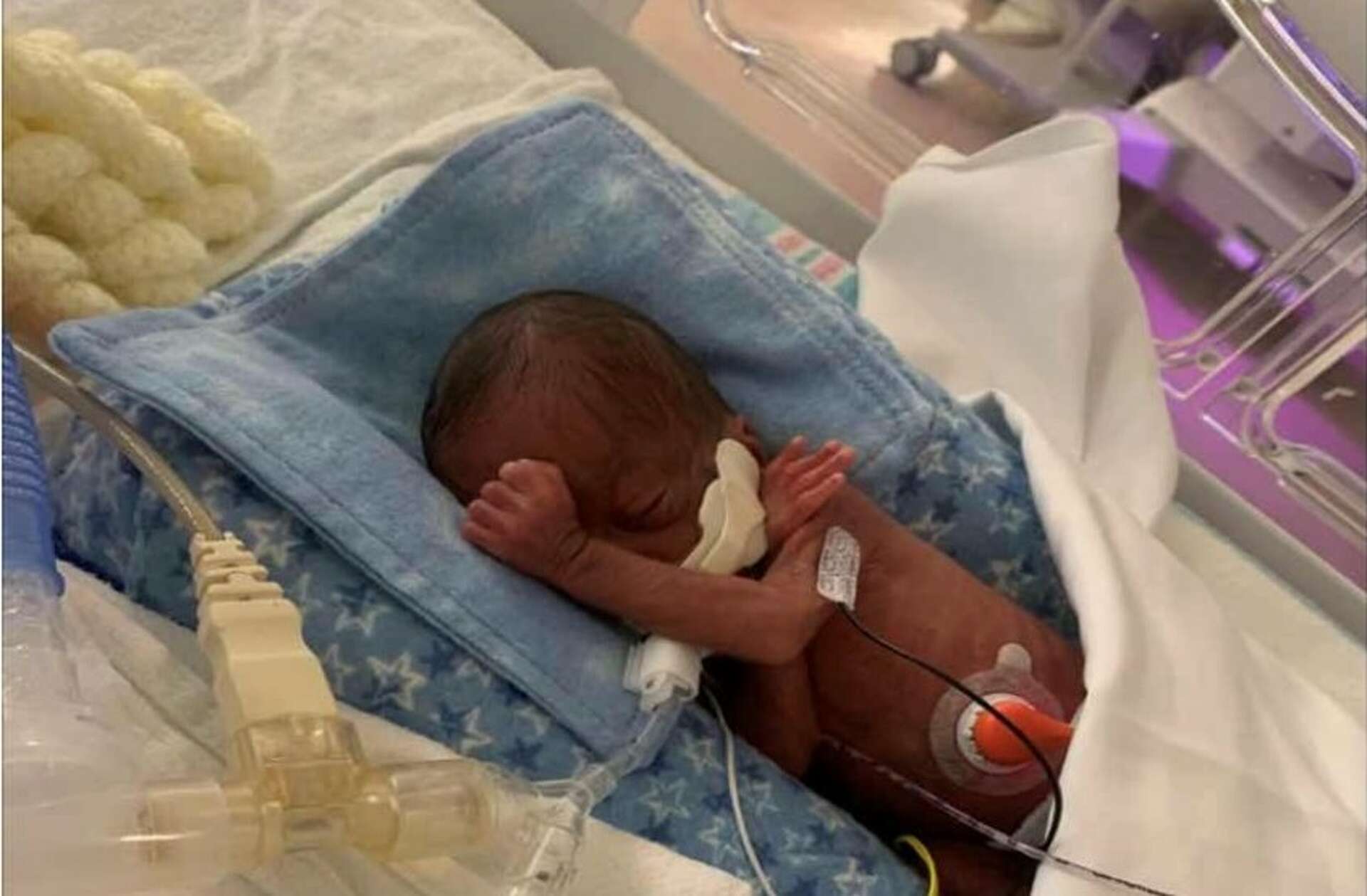 Parents sue state, contend baby died due to failed UConn diagnosis