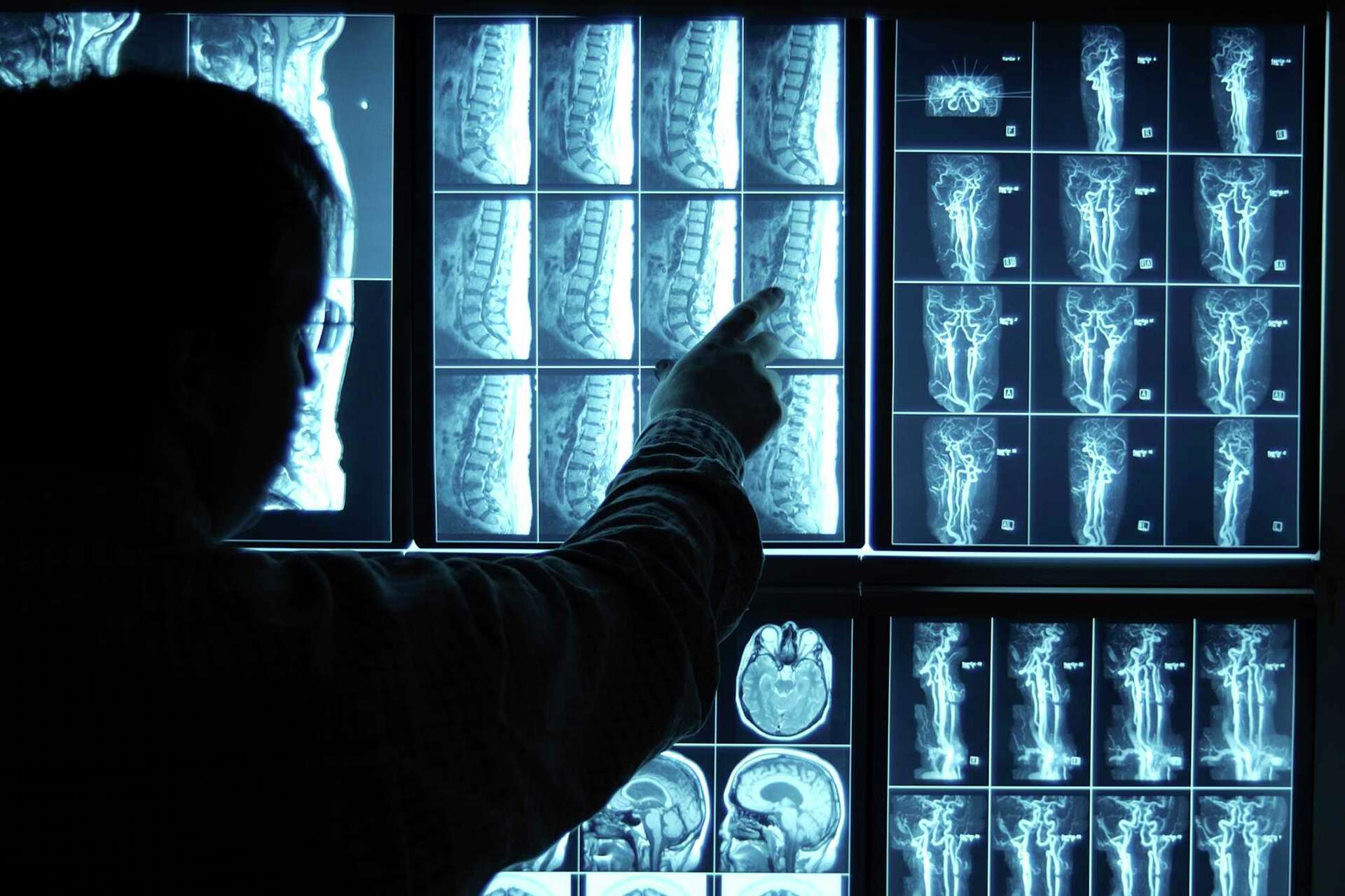 are neurologists in demand