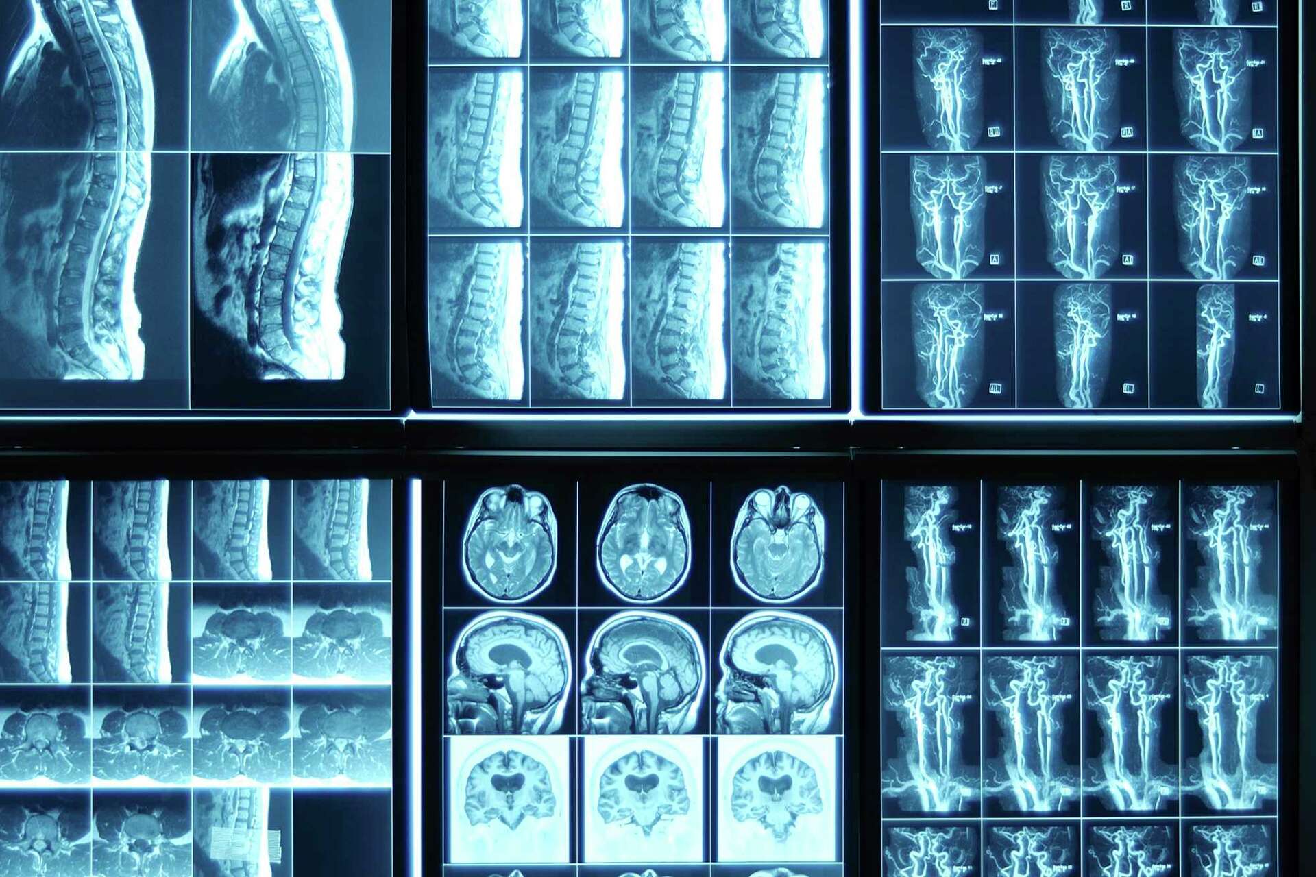 Radiology Tech Jobs in the Criminal Field