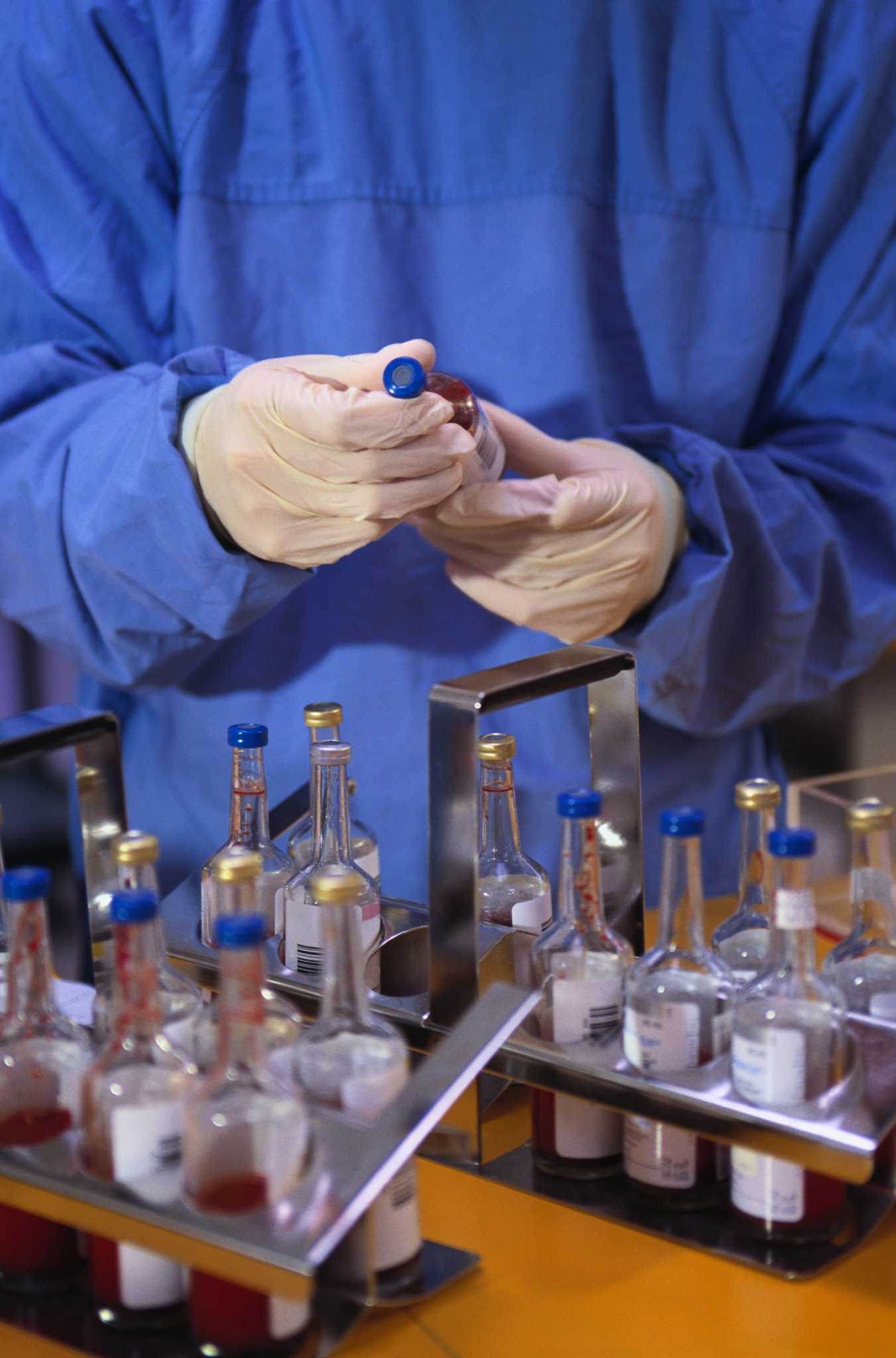 The Salary of a Medical Laboratory Technician