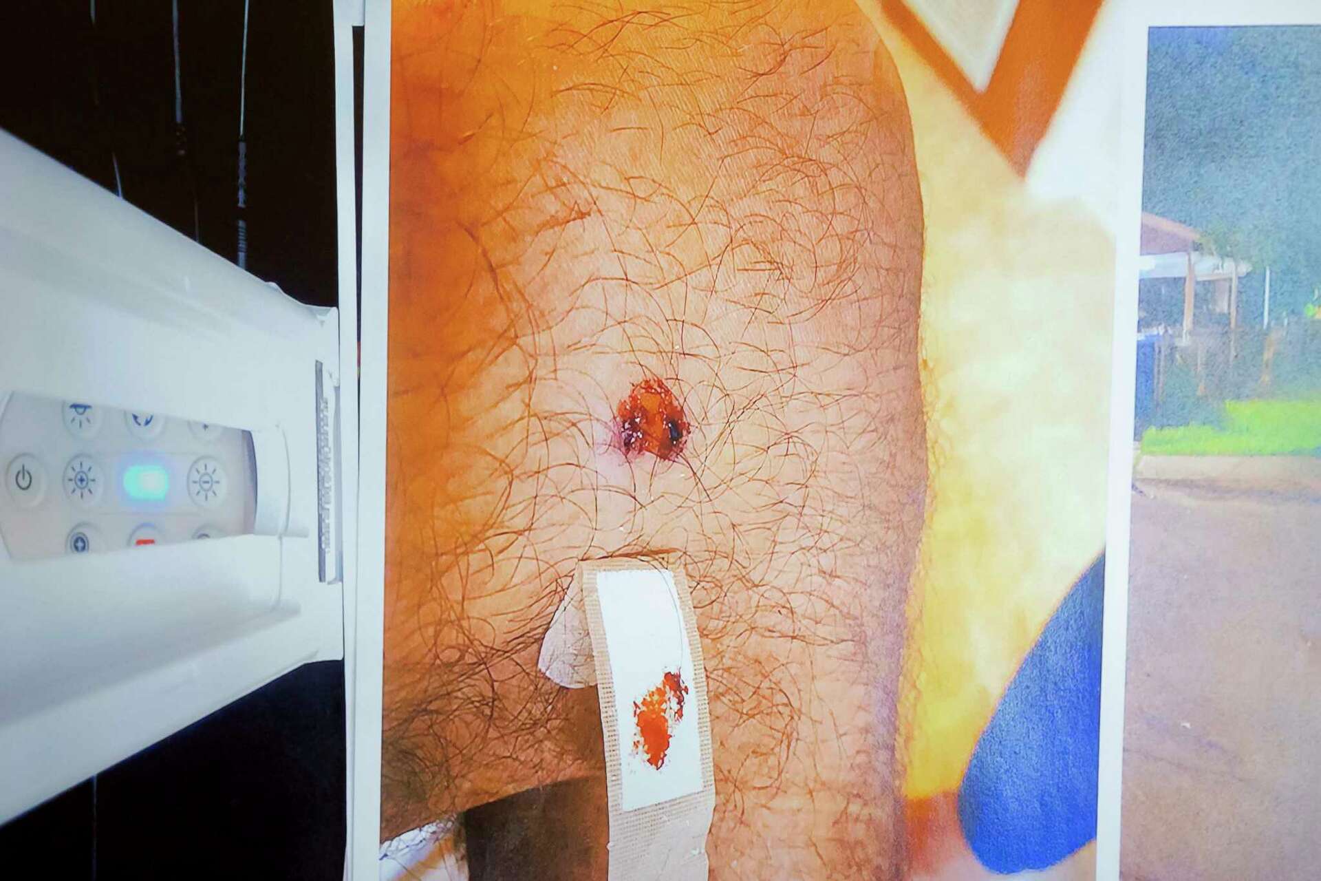 Witness: Texas couple's dogs bloodied him months before fatal mauling